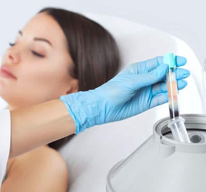 Platelet Rich Plasma Injections Toronto | Fairview Laser Clinic Inc.