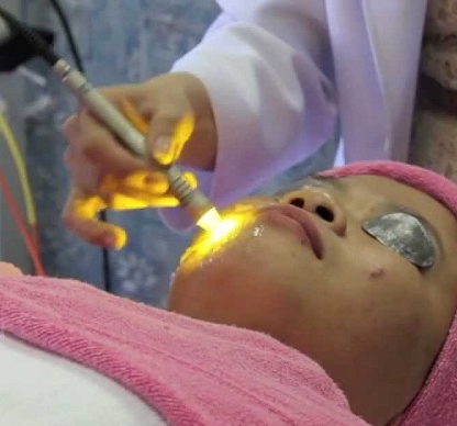 Quadro Pro Yellow Laser Toronto | Fairview Laser Clinic Inc.